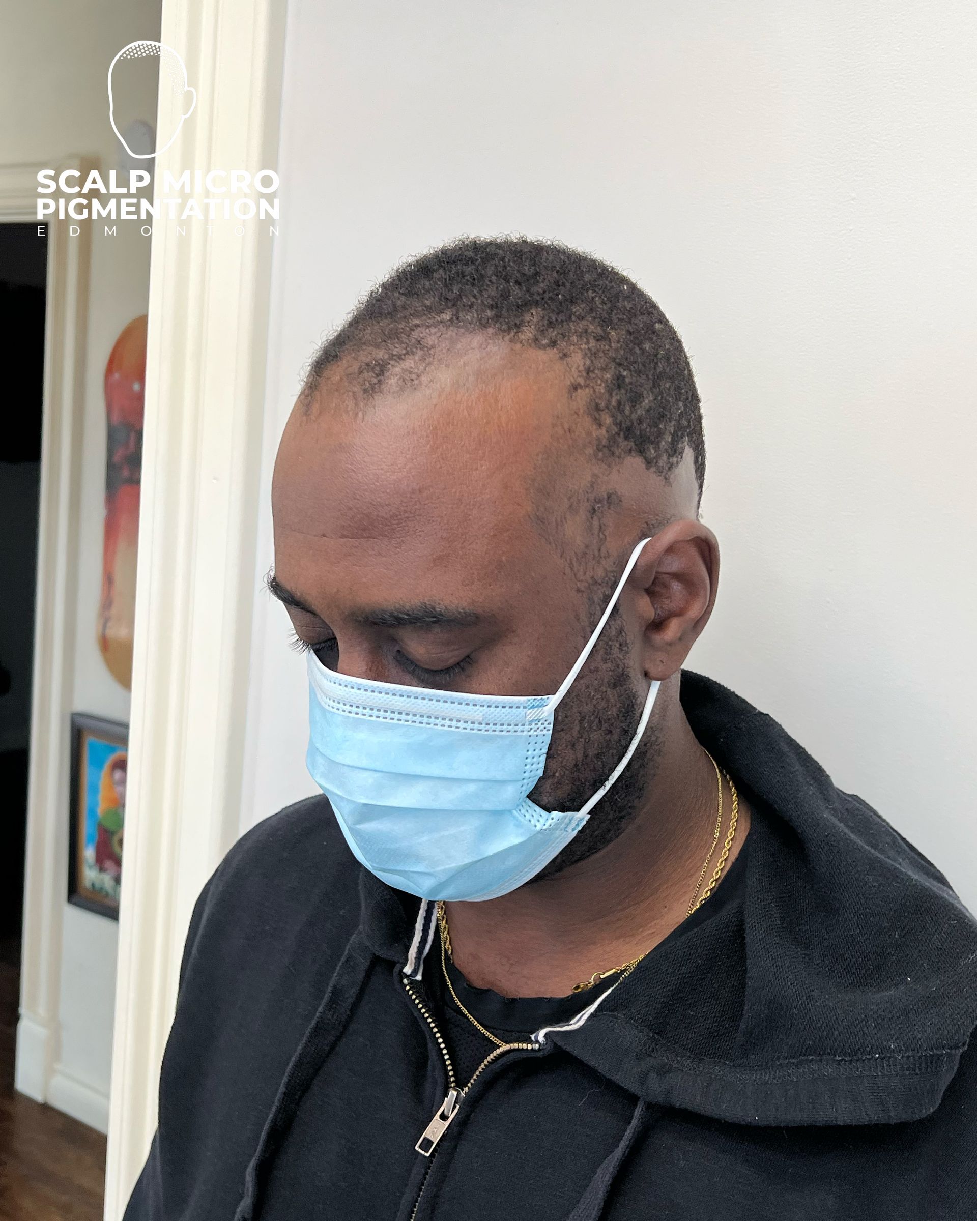 Before & After Photos | SMP Edmonton