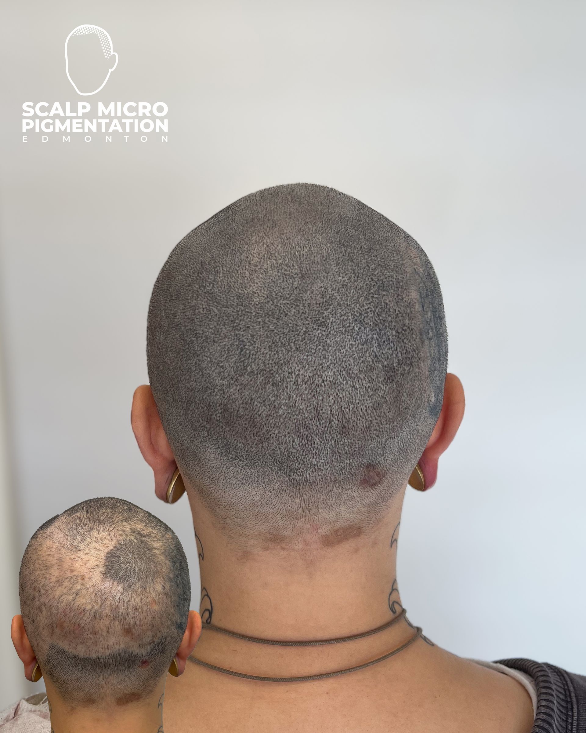 Client Profiles | SMP Edmonton | Edmonton Alberta