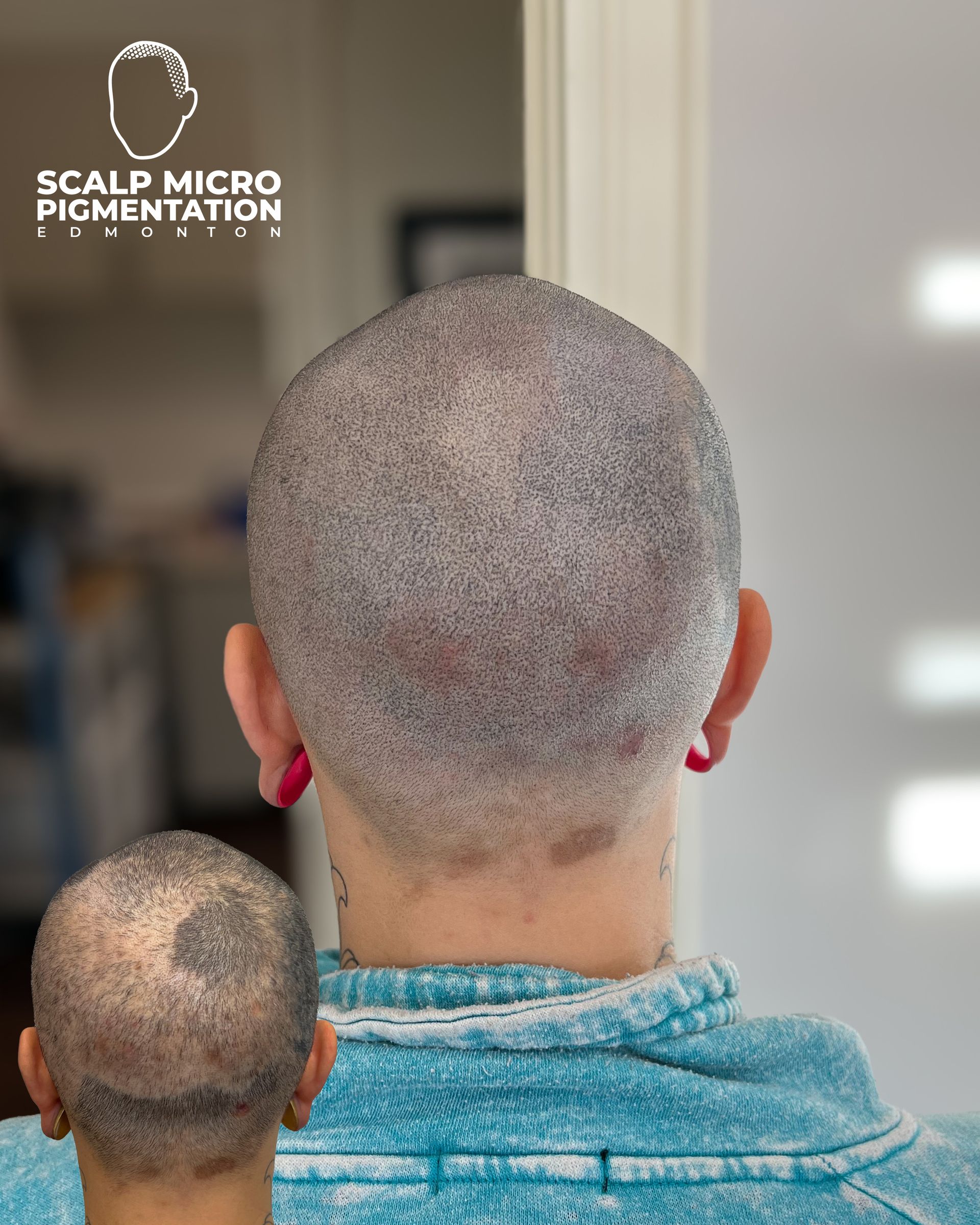 Client Profiles | SMP Edmonton | Edmonton Alberta