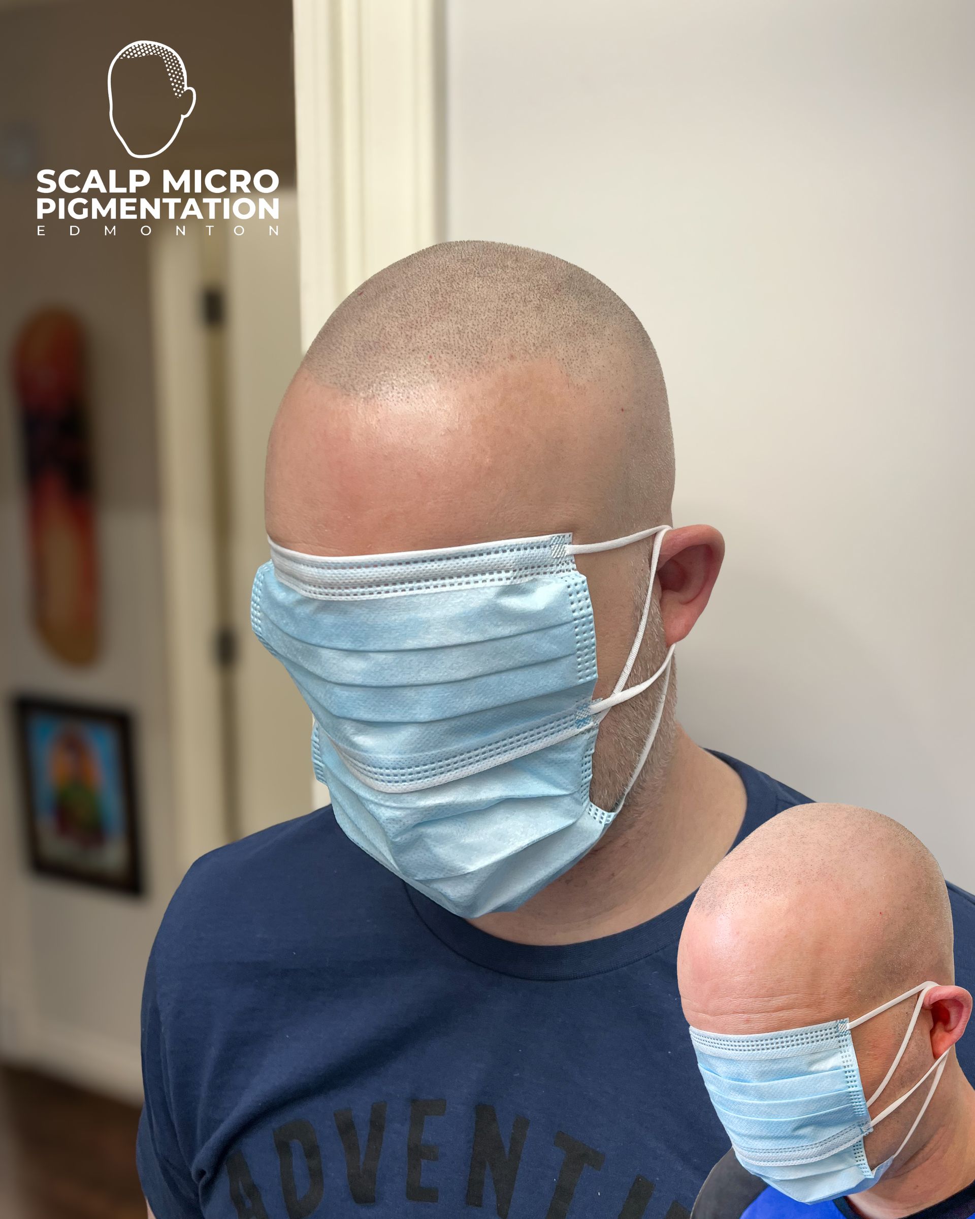 Before & After Photos | SMP Edmonton