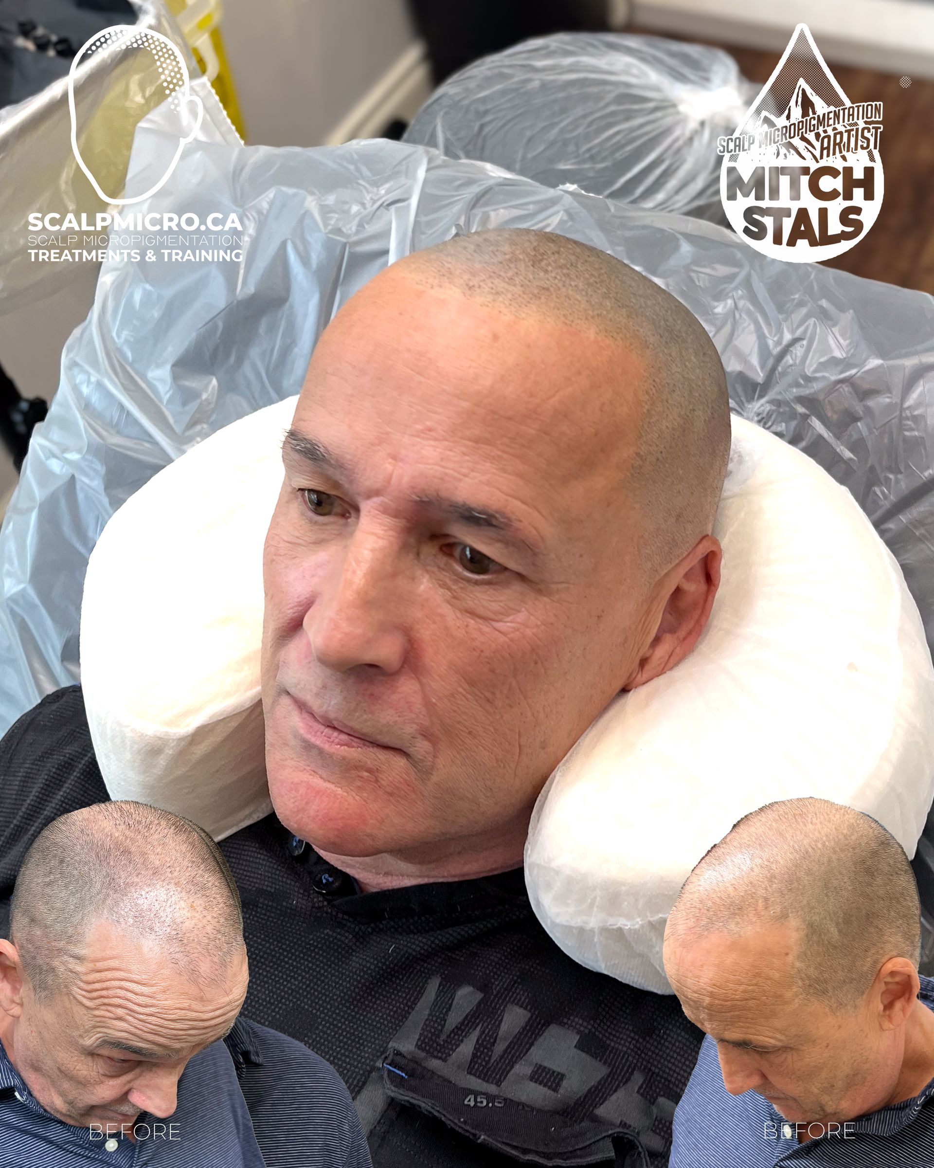 Before & After Photos | SMP Edmonton