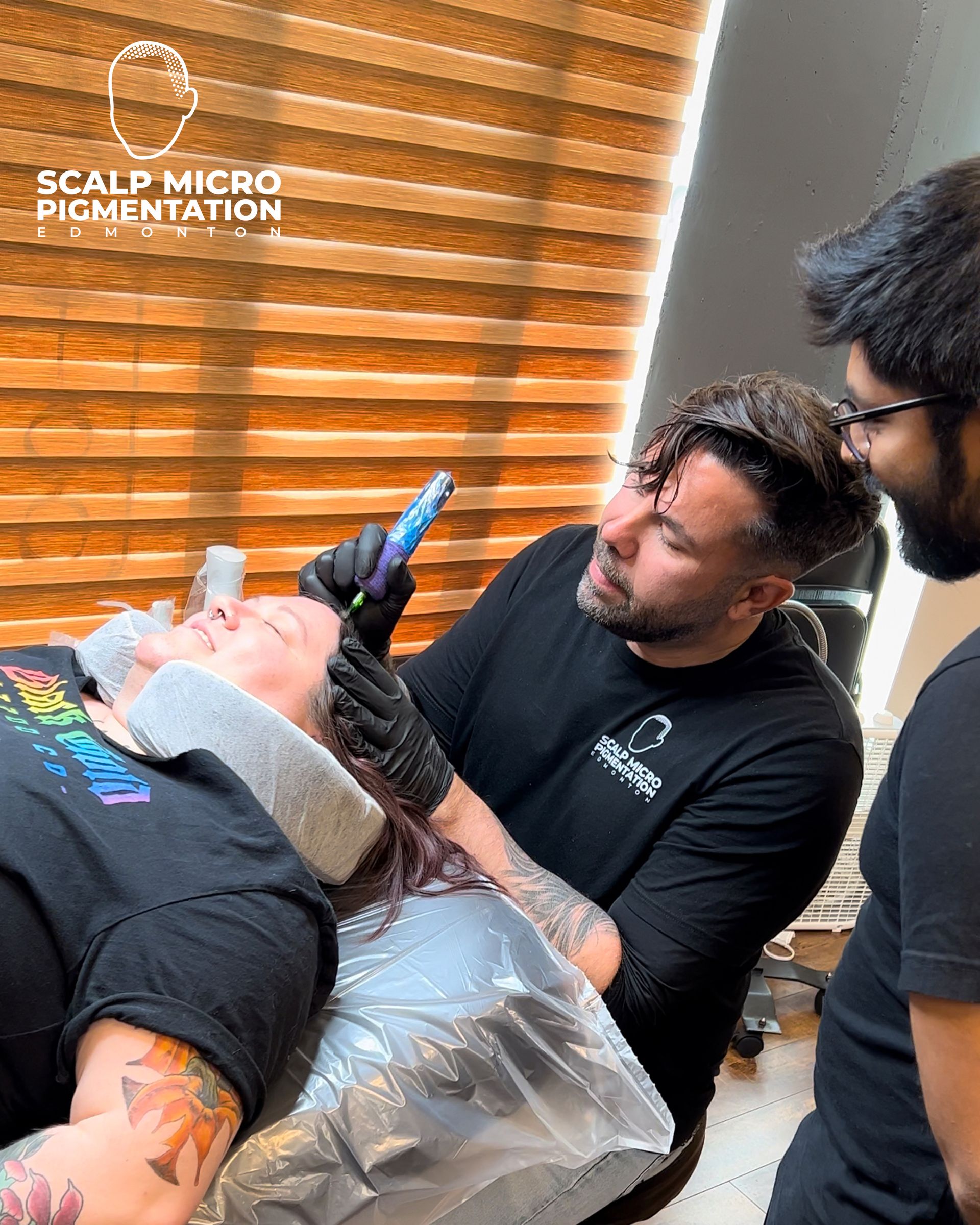 Scalp Micro Pigmentation Edmonton SMP - Hair Tattoo - Bald and Thinning ...