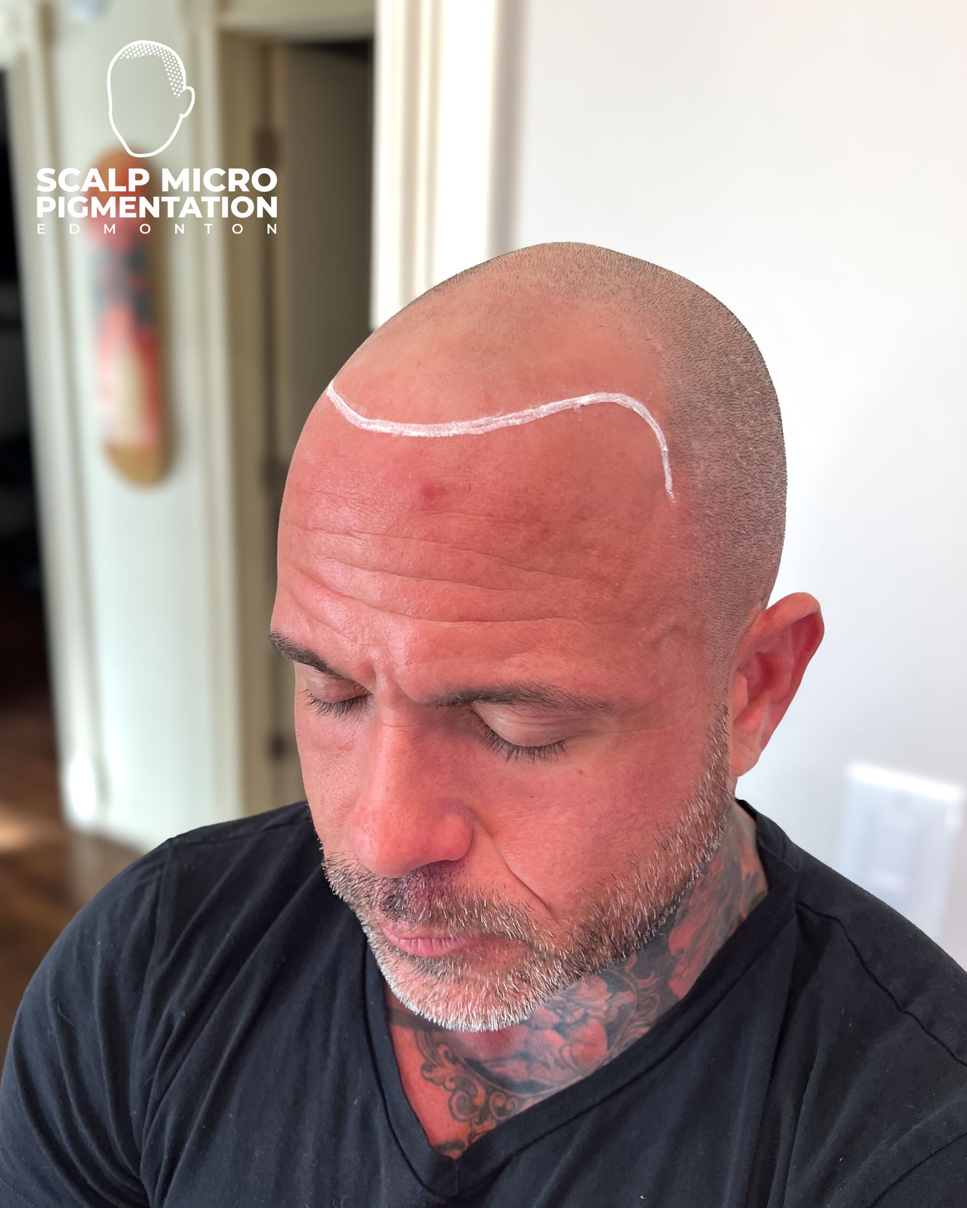 Male Client M78 | SMP Edmonton | Edmonton AB