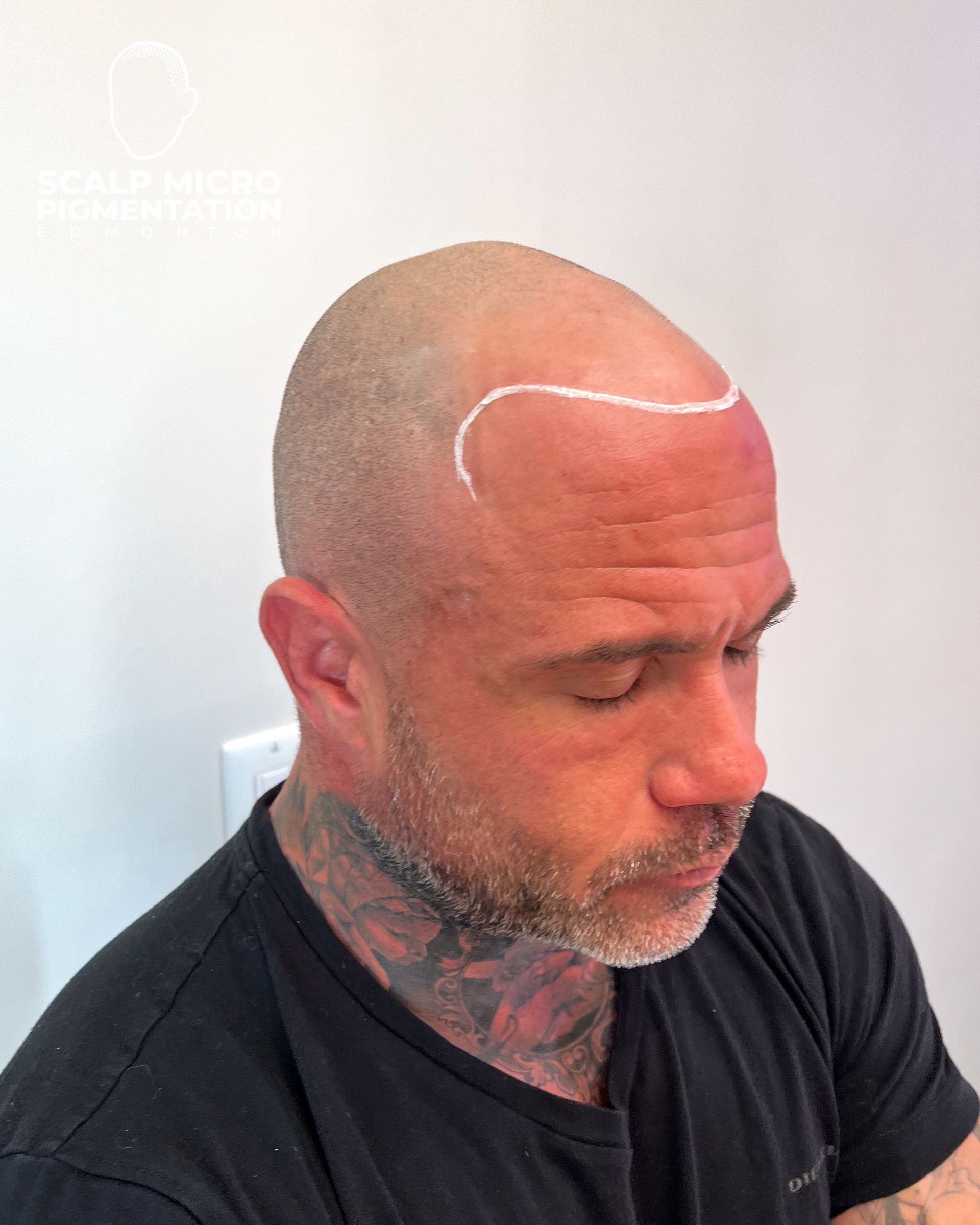 Male Client M78 | SMP Edmonton | Edmonton AB