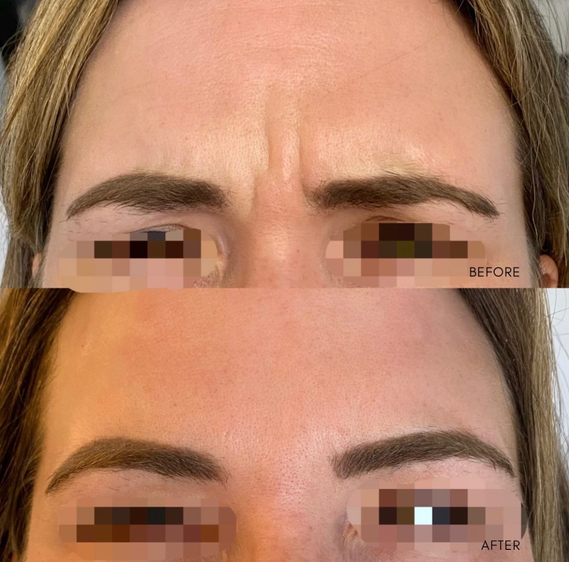 Gates Medical Spa | Skin Care & Laser Hair Removal | Body Contouring