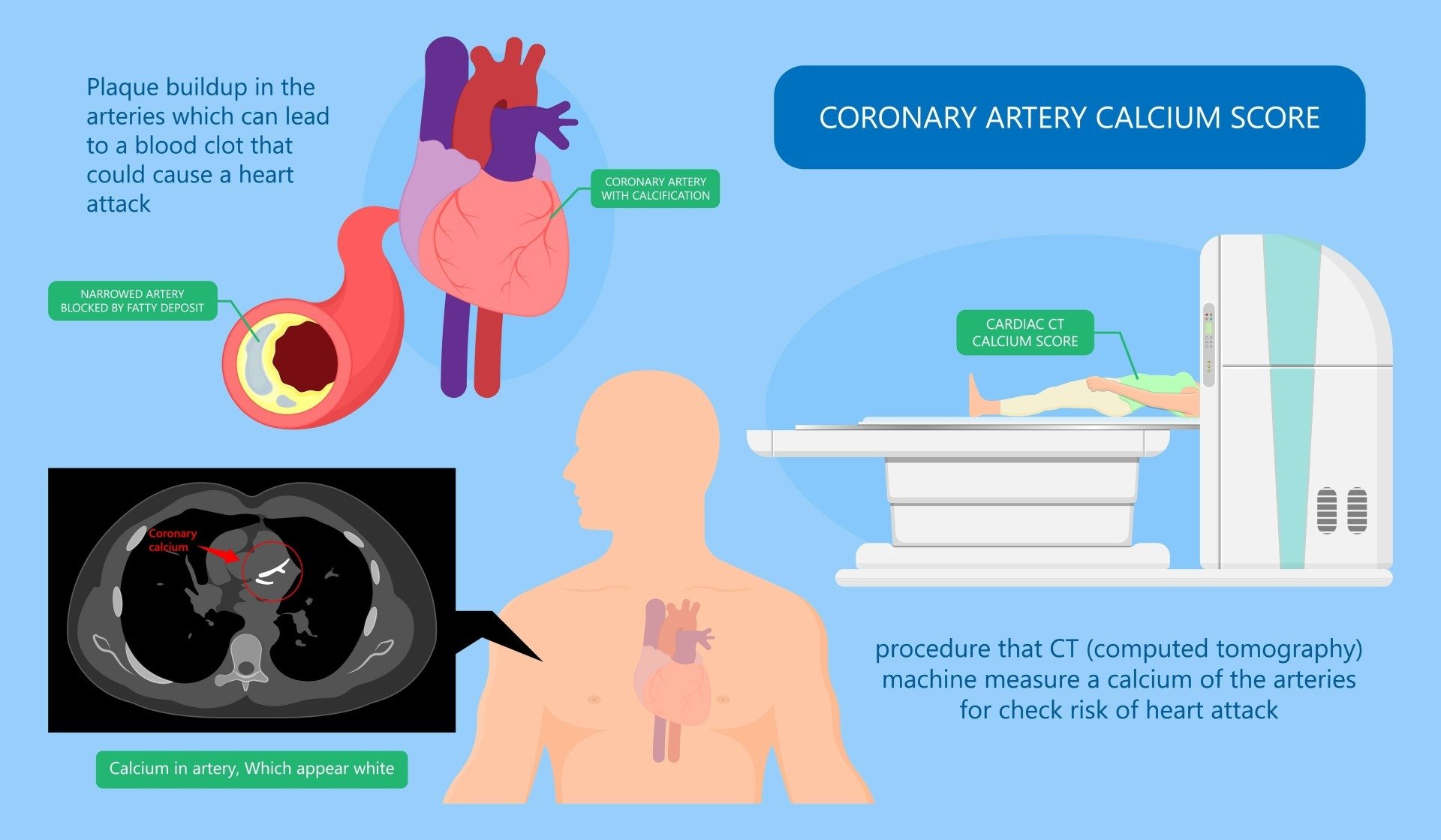 Understanding - CARDIAC CT FOR CALCIUM SCORING | MRI PLUS