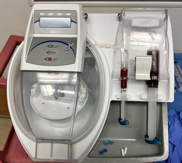Central Florida Autotransfusionist | Advanced Blood Management
