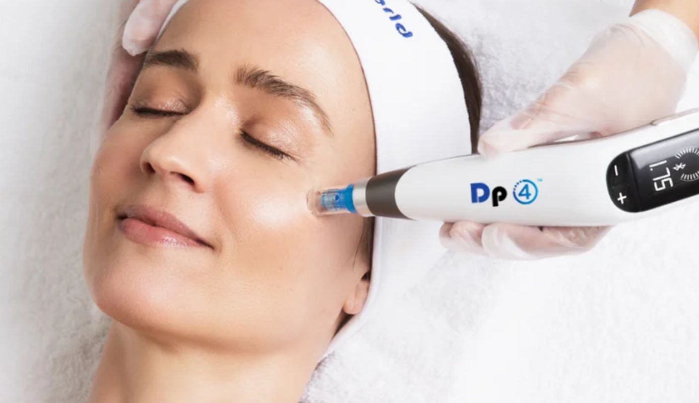 Microneedling PRP | Toronto,ON | NEA: Nurse Emily Aesthetics