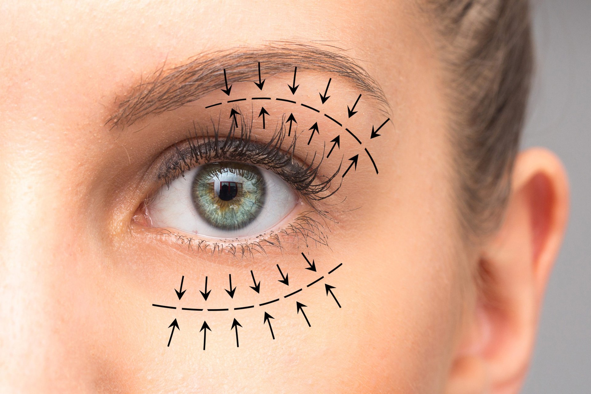 Clinique O - Chirurgie Plastique et Esthétique de l'oeil à Montréal et ...