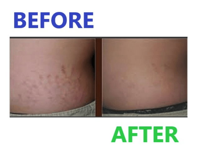 invisa-RED | The Phoenix Edge