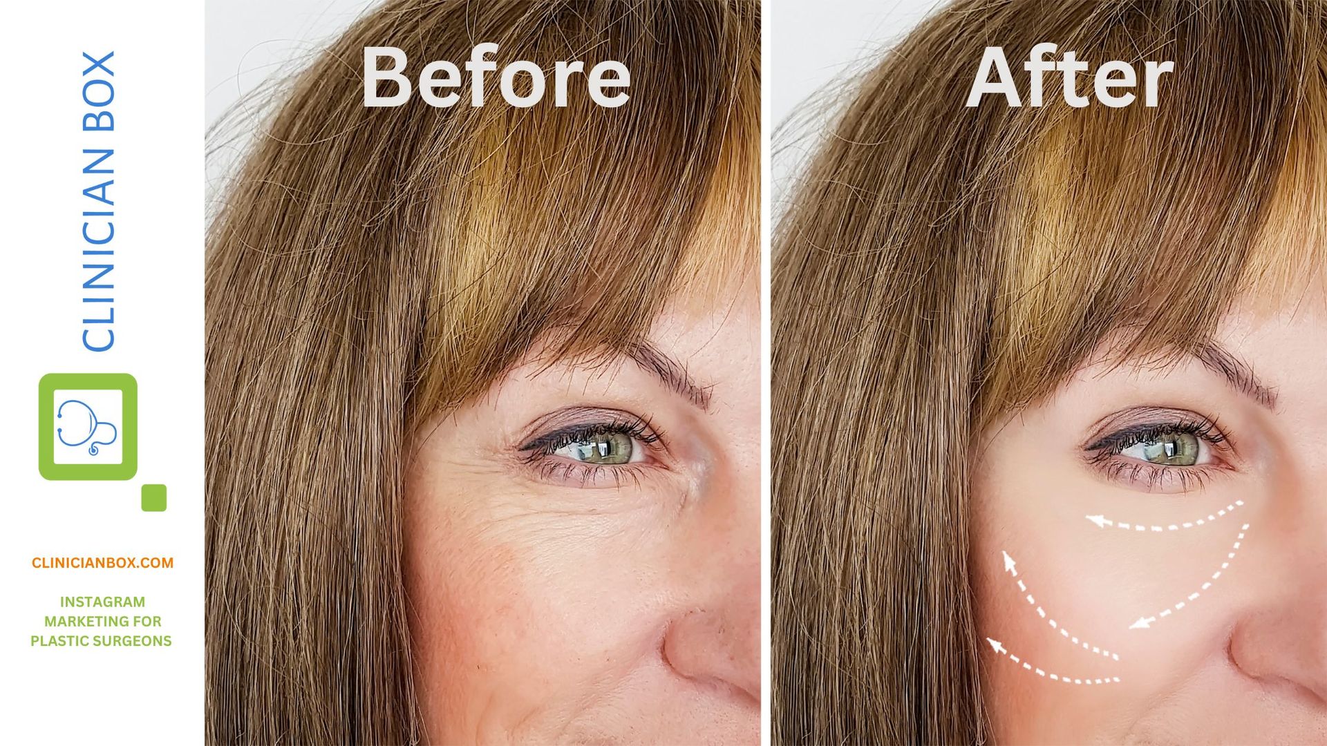 Using Instagram to Grow Your Plastic Surgery Practice