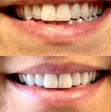 Dentist in Miami Beach FL | Miami Beach Dental Solutions