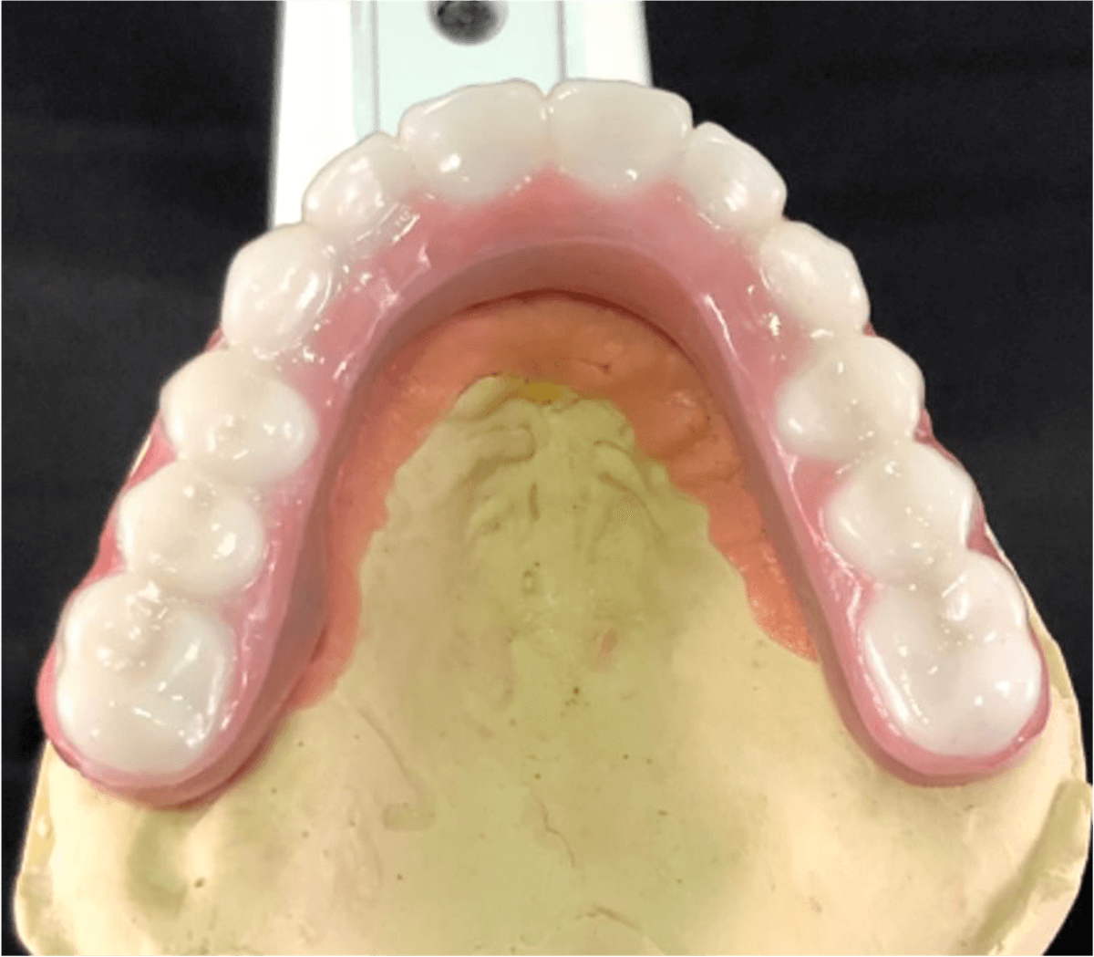 360 IPRO | Hershberger Dental Lab