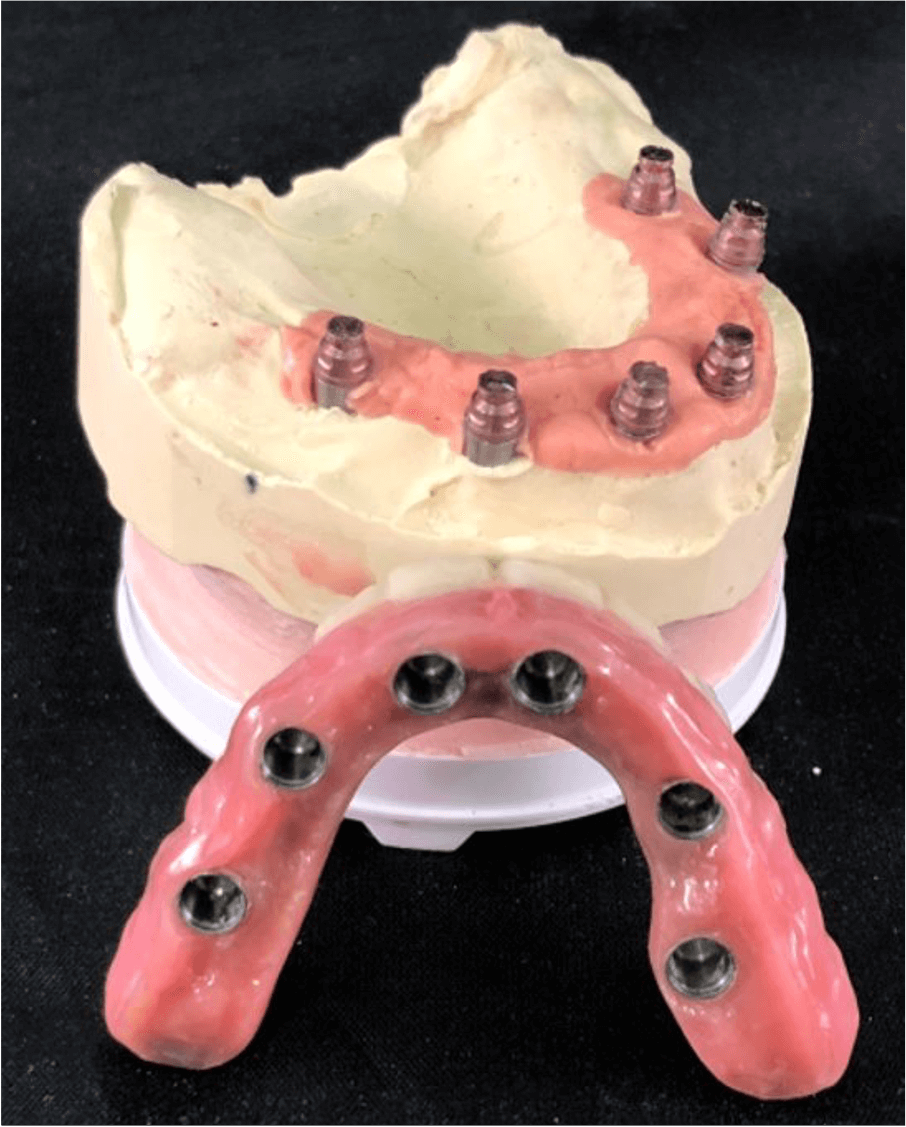 360 IPRO | Hershberger Dental Lab