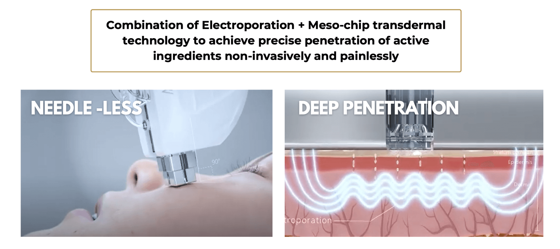 Meso Skin Infinity Skin Booster, needleless, Rejuran