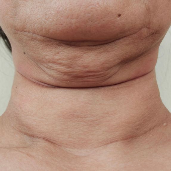 Aesthetic & Skin Rejuvenation Clinic York | New Street