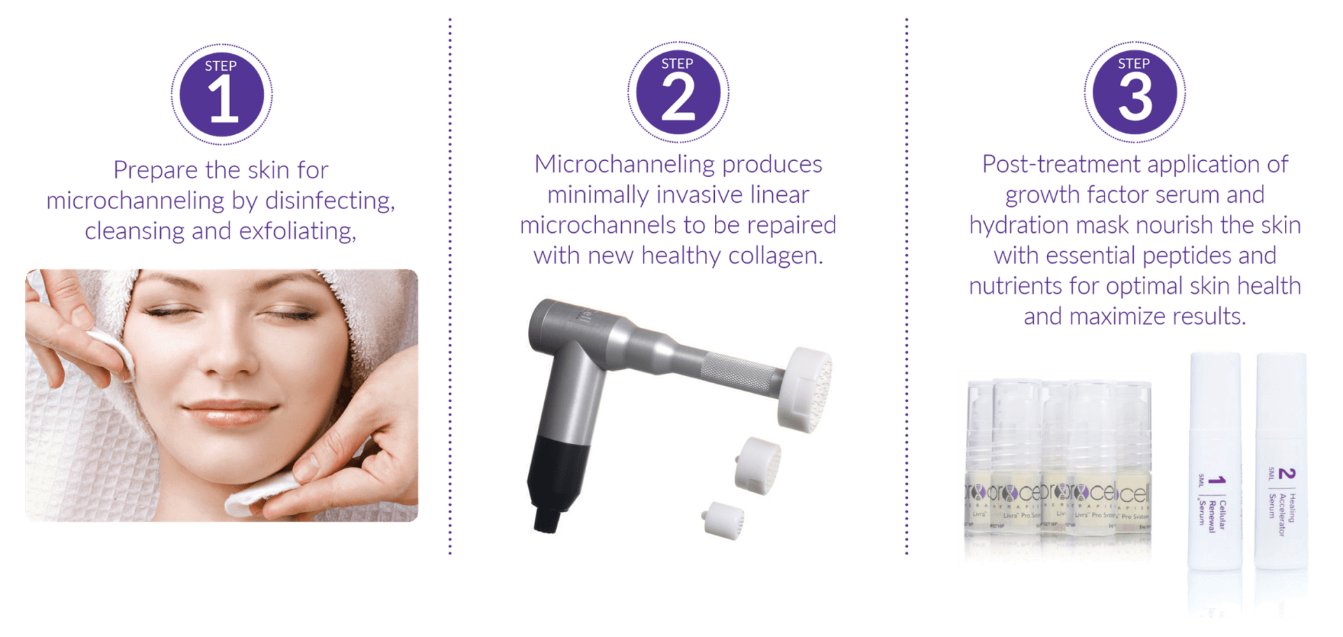 Microchanneling | Moodz Salon & Spa | Acton, MA & Wayland, MA