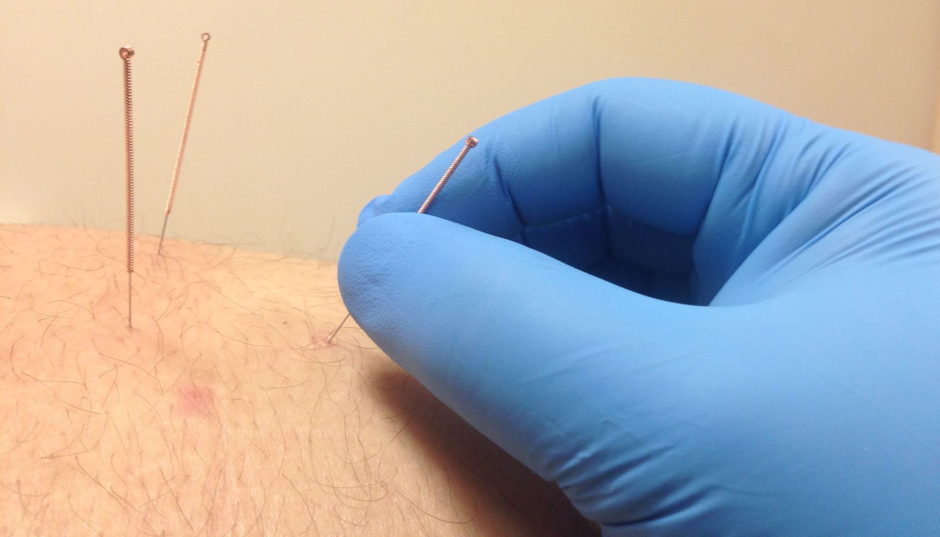 Introductory Level Dry Needling Course