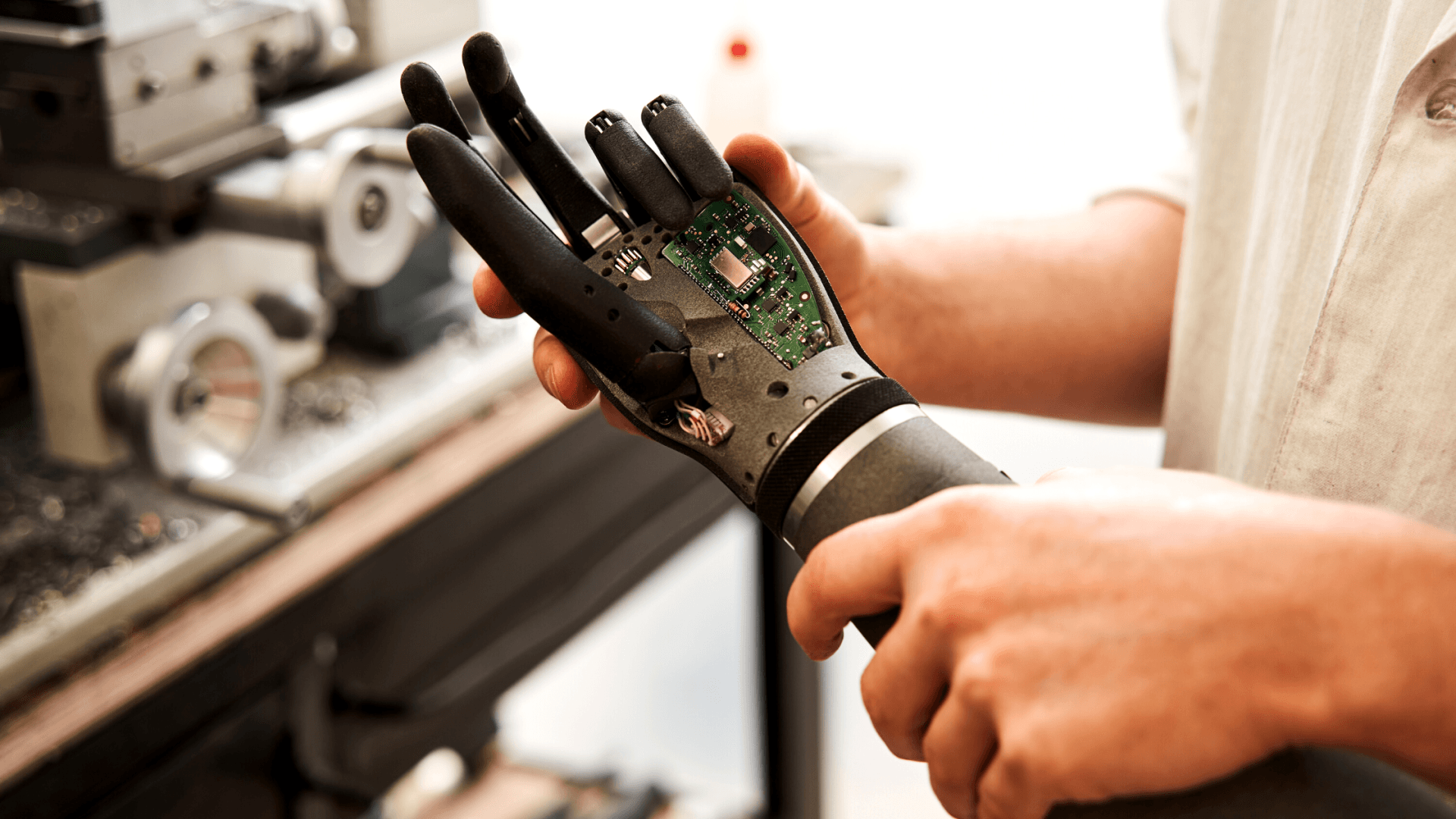 Tipos de amputação de membro superior