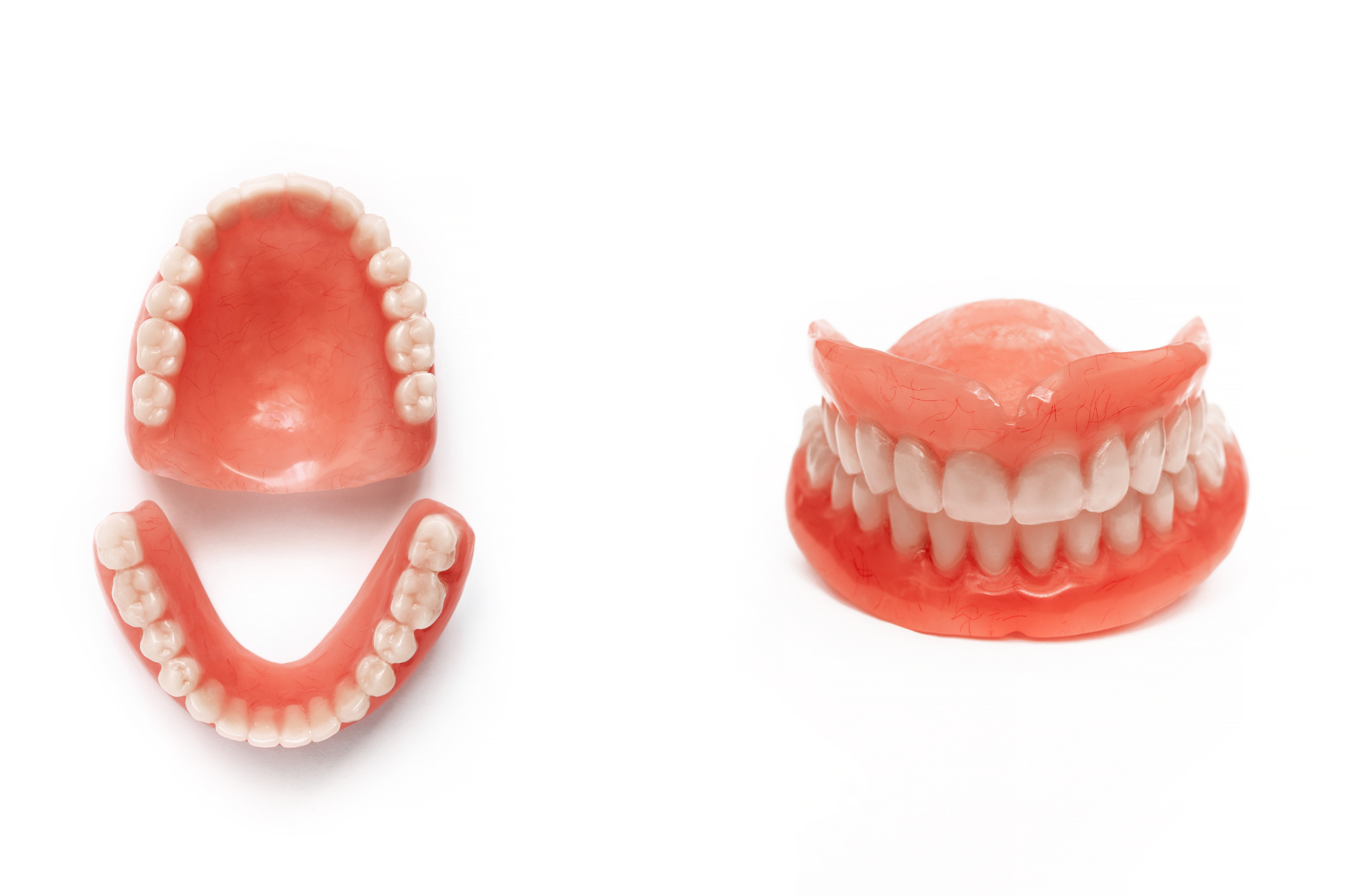 Insights on Full Mouth Restoration