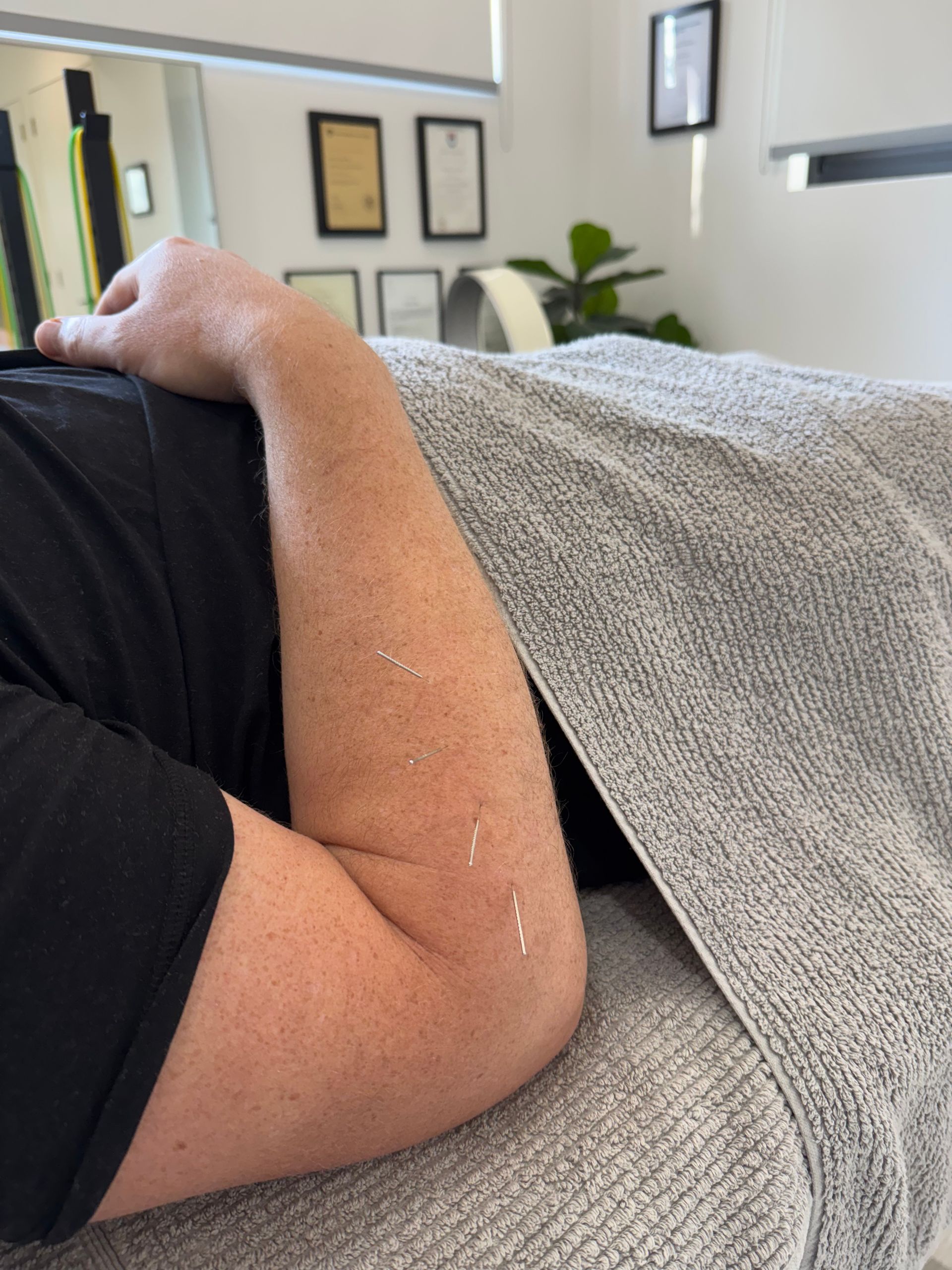 Elbow Pain | PACT Physio & Rehab
