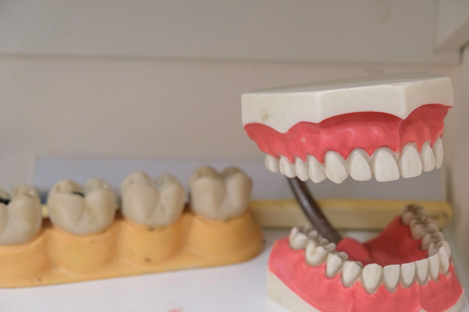 Venice, Florida, Implant-Supported Dentures | Dental Implants Today